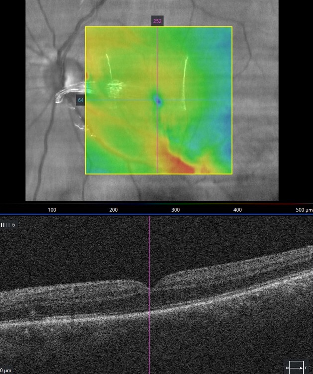 Reconnection – on the road to recovery. | 2slowspeeds